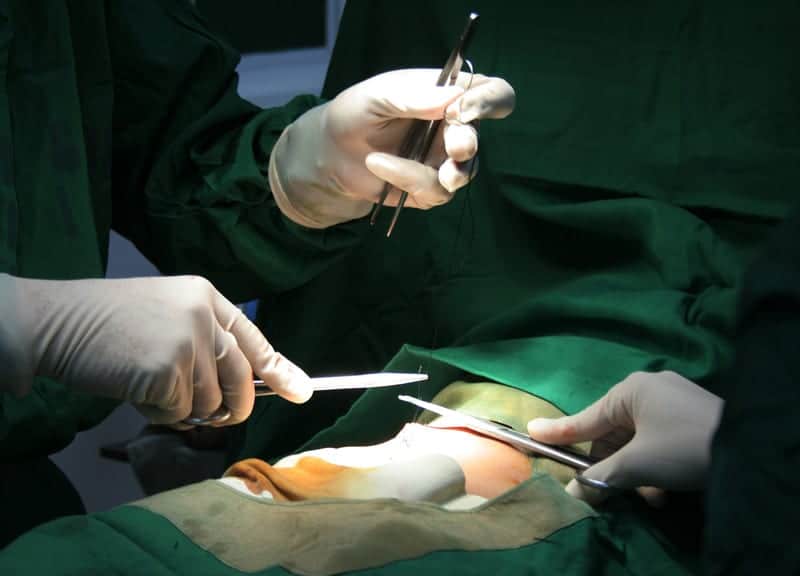 Private Stitch removal London (£60) - Private GP Surgery - Skilled Nurses